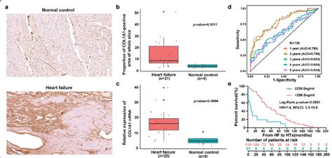 Validation Of Col1a1 Gene Expression By Ihc And Qrt Pcr And A Predictor