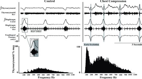 E1 Thyroarytenoid Activity During Control Conditions Eupnea And Chest