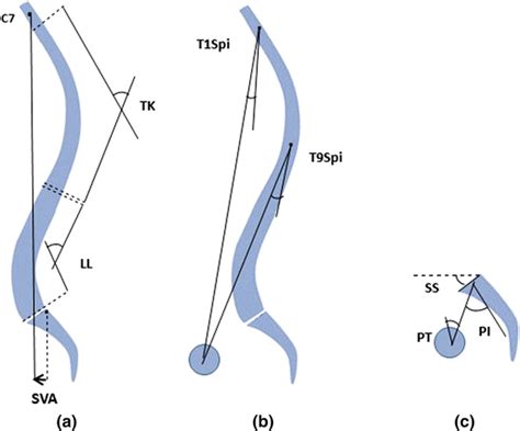 Spinopelvic Parameters Ll Lumbar Lordosis Tk Thoracic Kyphosis Sva