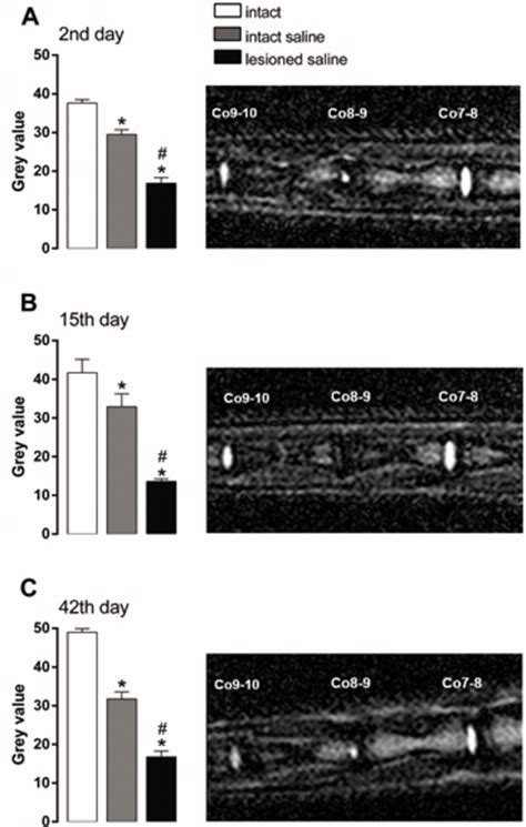 Mri Signal Intensity Data Are Described As The Mean Value Of A Grey