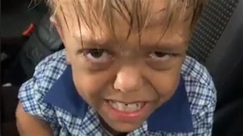Mother Shares Video Of Distraught Son 9 Bullied Over His Dwarfism