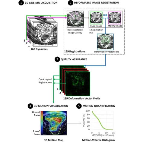 Schematic Representation Of The Framework For Bowel Motion