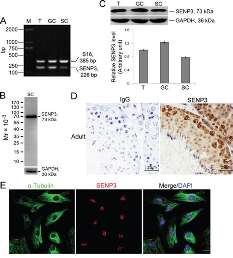 Senp3 Grants Tight Junction Integrity And Cytoskeleton Architecture In