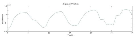 The Respiratory Waveform Generated By The Prototype Download