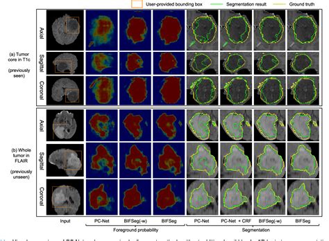 Interactive Segmentation Models Code And Papers Catalyzex