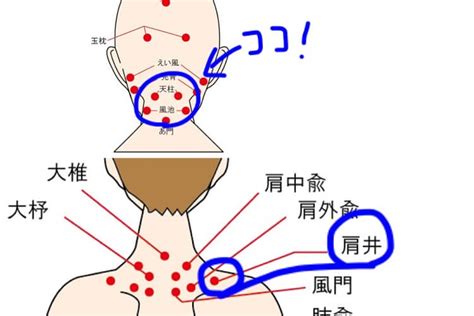 頭痛や片頭痛に効果をあらわすツボを現役の鍼灸師が紹介します 【公式】よしかい鍼灸院｜小田原で不妊治療・妊活にも強い鍼灸