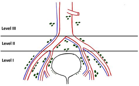 Pelvic Lymph Node Dissection Boundaries