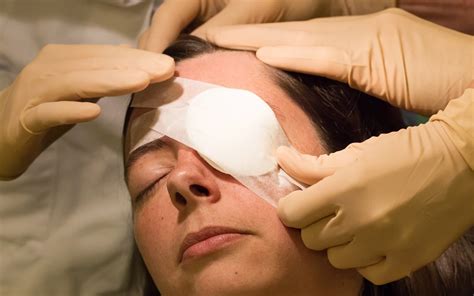 Cataract Surgery Recovery Immediately After Surgery And Beyond