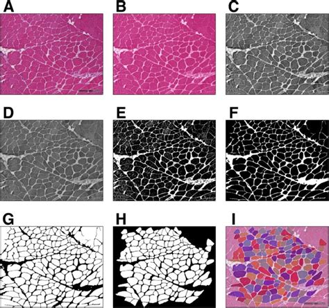 myofibre segmentation in hande stained adult skeletal muscle images using