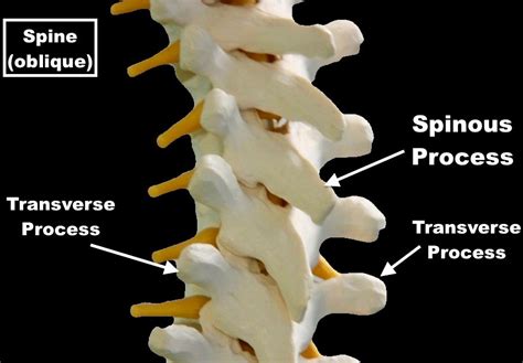 Cervical Transverse Process Fracture