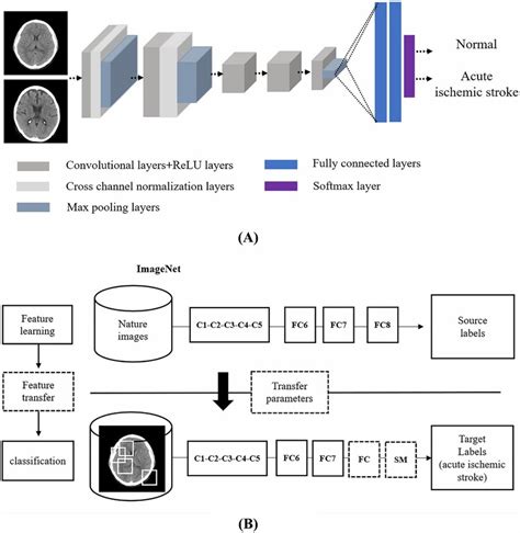 Illustration Of The Basic Dcnn For Acute Ischemic Stroke Image