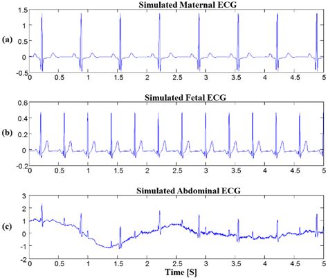 Figure 2 From Sequential Total Variation Denoising For The Extraction