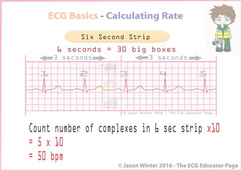 There Are Several Methods For Determining Heart Rate Our First Method
