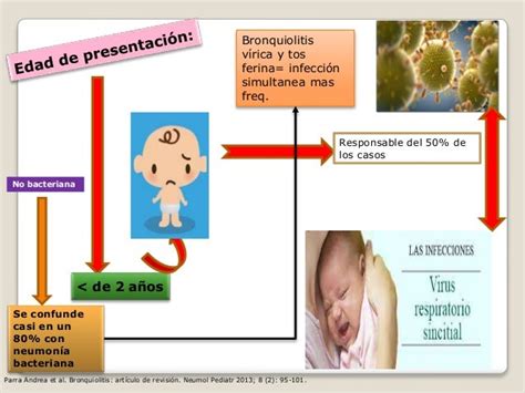 Bronquiolitis Pediatría