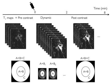 Variable Spatiotemporal Resolution Three Dimensional Dixon Sequence For