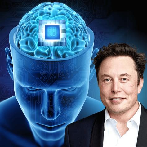 Primer Implante De Un Chip Cerebral El Increíble Anuncio De Elon Musk