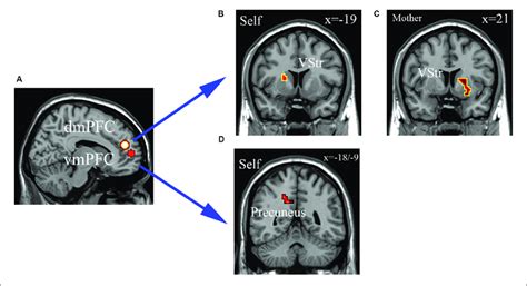 The Generalized Psychophysiological Interaction Gppi Analysis A