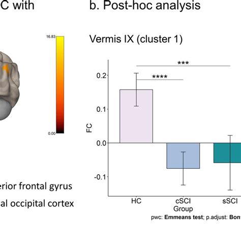 Functional Connectivity Group Differences In The Cerebellum A The