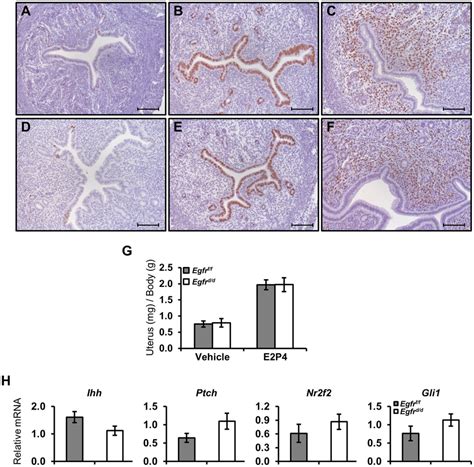 Ablation Of Egfr Does Not Alter Delayed Pregnancy Proliferation Or