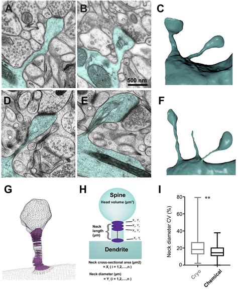 Ultrastructural Comparison Of Dendritic Spine Morphology Preserved With