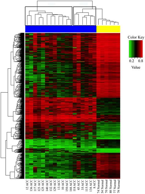 Unsupervised Clustering Analysis Of Normal And Acc Samples Using Dml
