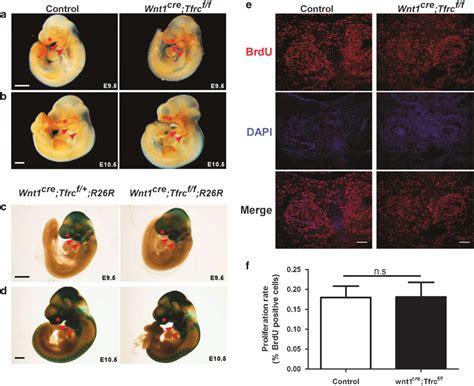 Conditional Deletion Of Tfrc In Nccs Does Not Affect Neural Crest