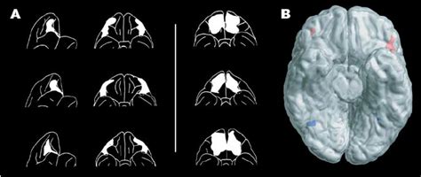 Reversal Learning And The Orbitofrontal Cortex Download Scientific