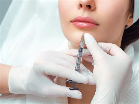 Preenchimento Labial Melhores Indicações E Quais Resultados Esperar
