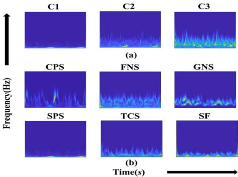 Figure 1 From Seizure Types Classification By Generating Input Images