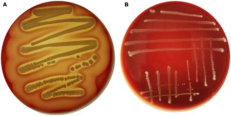 Frontiers Evaluating The Safety Of Potential Probiotic Enterococcus