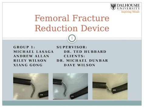 Pptx Femoral Fracture Reduction Device Dokumen Tips