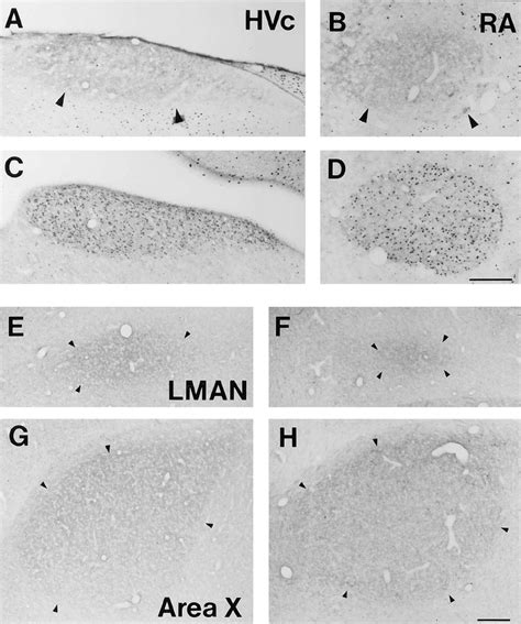Singing Induces Expression Of Fos In Hvc And Ra Of Male Adult Zebra
