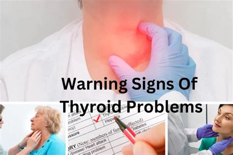 Early Warning Signs Of Thyroid Problems Dont Ignore Them