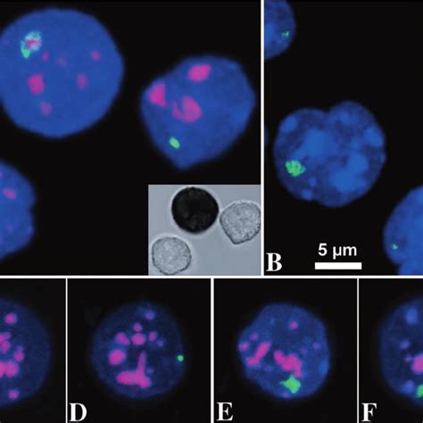 Volume Measurements Of Transgene Arrays In β Galactosidase Expressing