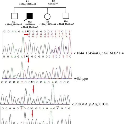 Pedigree And Sanger Sequencing Validation Of Compound Heterozygous