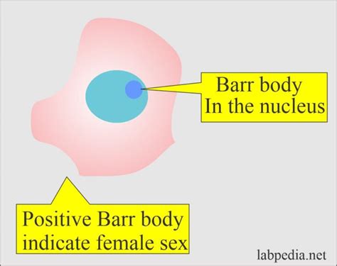 barr bodies detection sex chromatin body nuclear sexing and