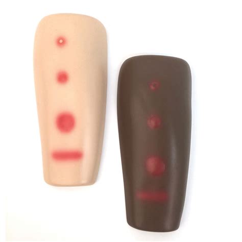 tuberculosis tb testing arm set health edco models