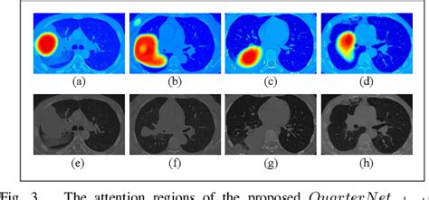 Figure 3 From A Quarter Split Domain Adaptive Network For Egfr Gene