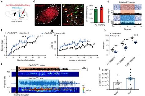 【nat Commun 】见微知著！浙江大学陈忠团队揭示黑质 丘脑通路促进颞叶癫痫的环路机制医药新闻 Bydrug 一站式医药资源共享中心 医药魔方