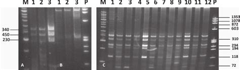 Restriction Fragment Length Polymorphism Analysis Of 1 246 Bp Fragment