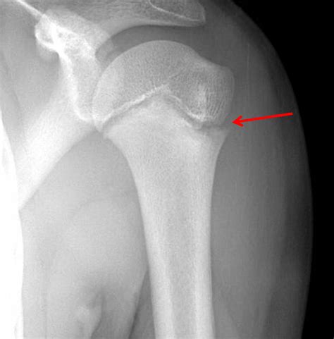 peds radiographs case 5