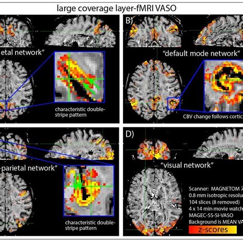 Functional Connectivity Data With Large Coverage Vaso Methods With The