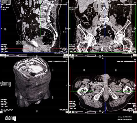 Mri Imagen De Resonancia Magnética Tomografía Computarizada De La