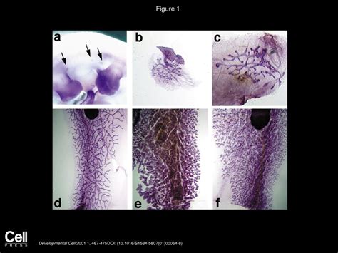 Signaling Pathways In Mammary Gland Development Ppt Download