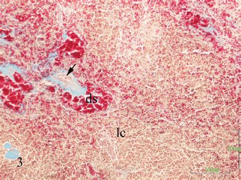 Paraffin Section Of Hemal Node Showing Deep Sinus Ds Lymphoid Cords