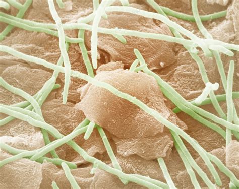 Trichophyton Interdigitale Stock Image C009 4096 Science Photo