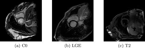 Figure 2 From Recognition Of Cardiac Mri Orientation Via Deep Neural