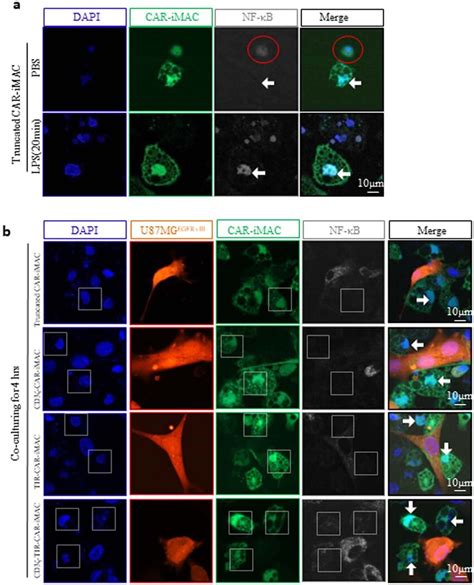 If Assays Showed Subcellular Localization Of Nf κb P65 In Car Imacs A