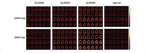 Spatial Snr Ssnr Map And Temporal Snr Tsnr Map Of A Download