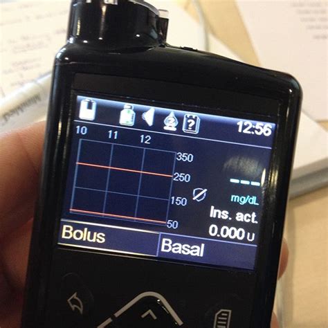 [actualizado] La Nueva Medtronic Minimed 640g